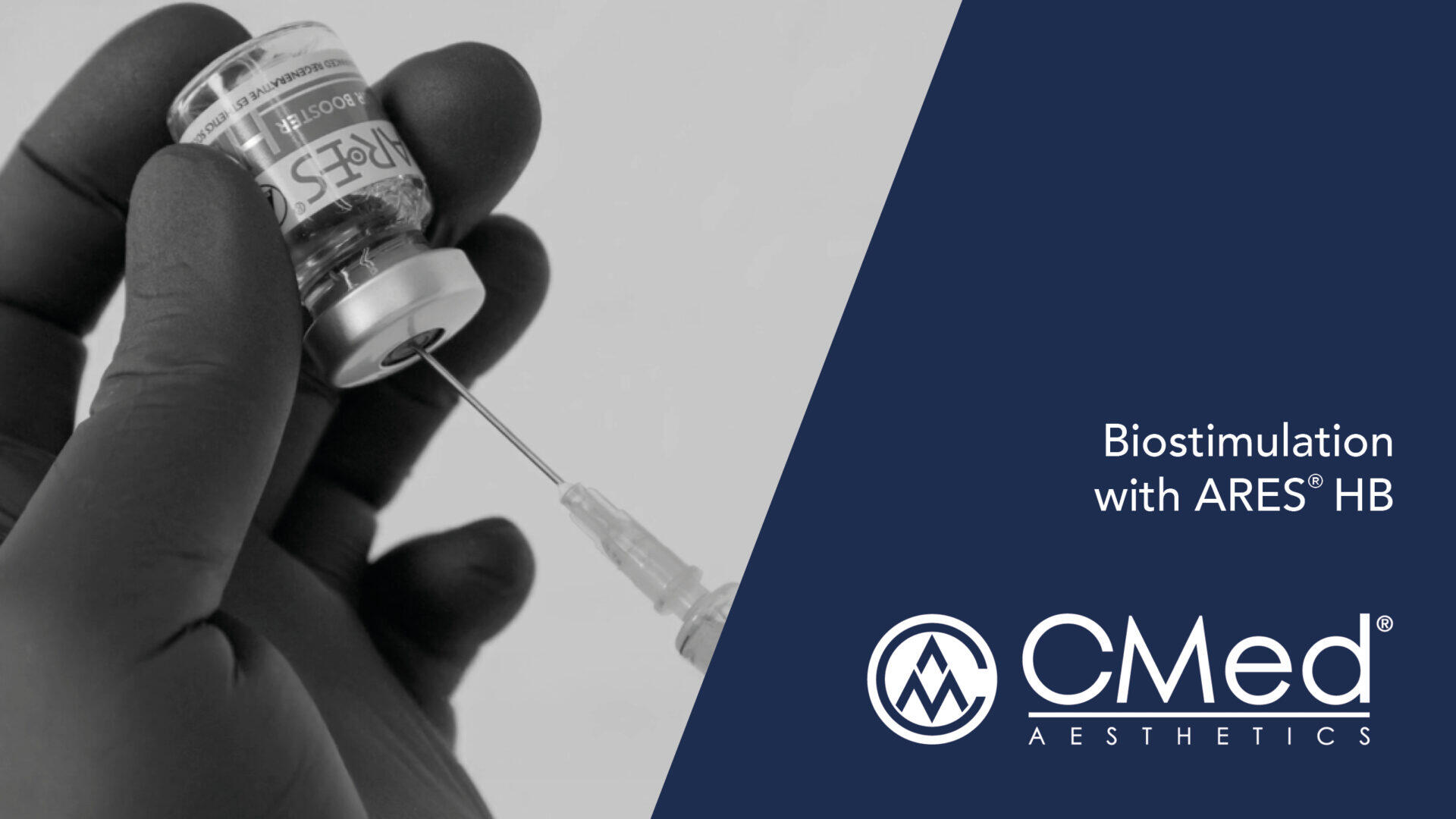 Biostimulation with ARES® HB - CMind